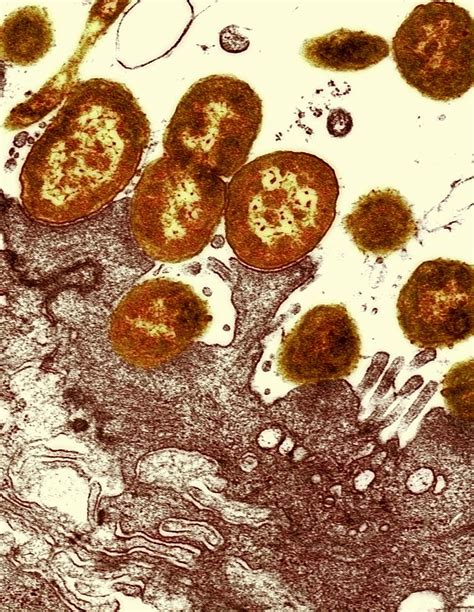 Intestinal Bacteria Tem Photograph By Biomedical Imaging Unit