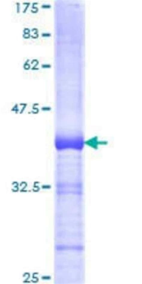 Novus Biologicals™ Recombinant Human Hnrnp M Gst N Term Protein 10 μg