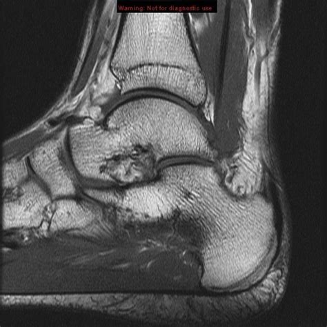 Ankle Mri Sag 6 Diagram Quizlet