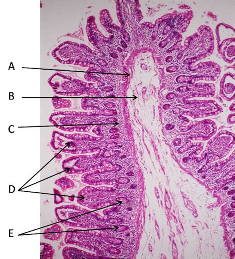 SOS BIOLOGIA CELULAR Y TISULAR DIGESTIVO INTESTINO Digestive Intestine
