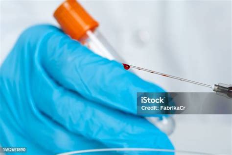 파란색 장갑을 낀 의사가 혈액과 주사기로 손 테스트 튜브를 유지합니다 Stem 주제에 대한 스톡 사진 및 기타 이미지