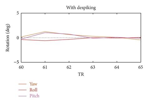 Improved Motion Correction By Adding Despiking Step The 6 Motion