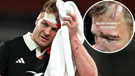 Rugby News 2024 All Blacks Vs France Sam Cane Head Injury New