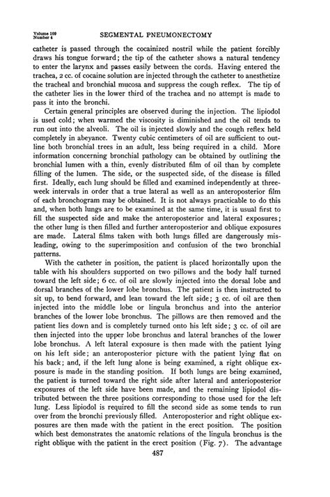 Segmental Pneumonectomy In Bronchiectasis The Lingula Segment Of The Left Upper Lobe Pmc