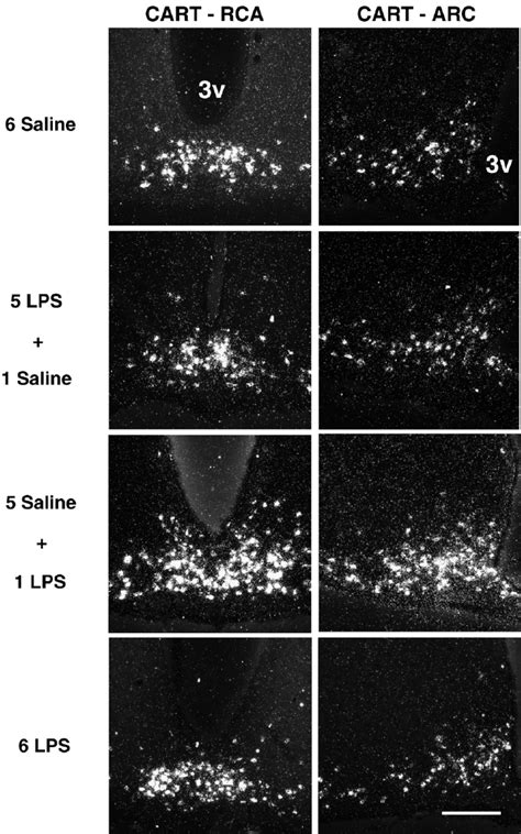 Representative Dark Field Photomicrographs Showing The Distribution Of