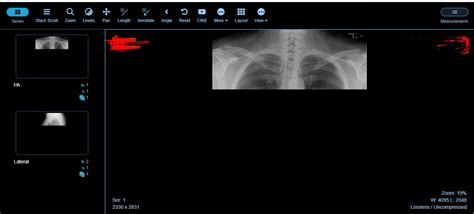 Display Half Image Issue Microsoft Dicom Server GitHub