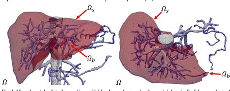 Figure 1 From Fast Computation Of Soft Tissue Thermal Response Under