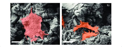 Sem Micrographs Of Osteoblastic Cells Mg63 After 3 D In Culture Cells