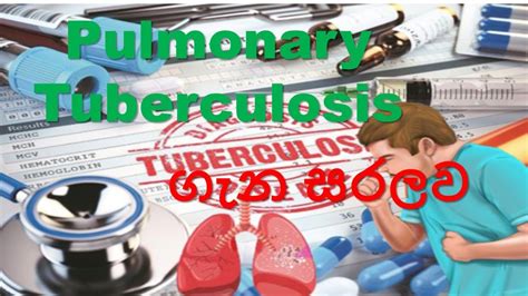 How to Prevent Tuberculosis In Sinhala All about Tb in Sri Lanka කෂය