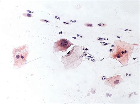 Cric Pap Smear Dataset Object Detection Dataset By Kp Viume