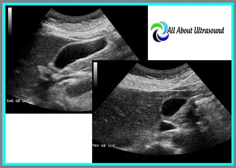 Making Waves™ Ultrasound Blog