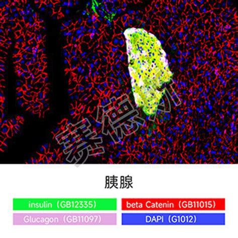 免疫荧光三标四色扫描分析全套（切片）合肥赛德斯生物科技有限公司