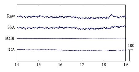 Results Of Eog Artifact Removal On An Example Eeg Data Set From The 20