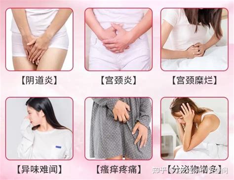 Hpv感染与宫颈癌，如何科学应对与预防？ 知乎