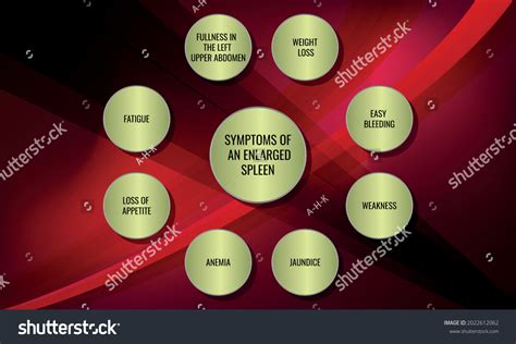 Symptoms Enlarged Spleen Vector Illustration Medical Stock Vector
