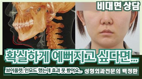 Sub 브이올렛 인모드 했는데 효과 못 봤어요 비대면상담 359 Briolette I Tried In Mode But It Didnt Work