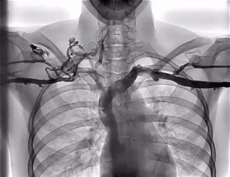 Просто о медицине 💉 Mediccuti • Instagram Photos And Videos