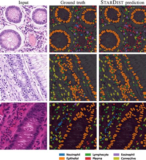 Nuclei Instance Segmentation And Classification In Histopathology