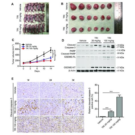 Triclabendazole Induces Apoptosis And Lytic Death In Breast Cancer