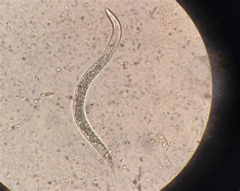 Shining A Light On Lungworm Dairy Country