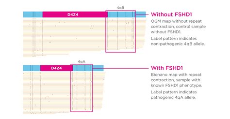 Genetic Disease Testing Bionano