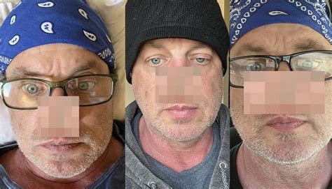 Mrsa Infection In Nose