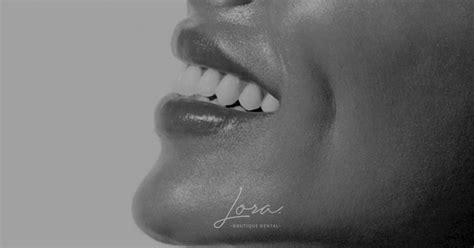 Preguntas Frecuentes Sobre La Ortodoncia Invisible Lora Boutique Dental