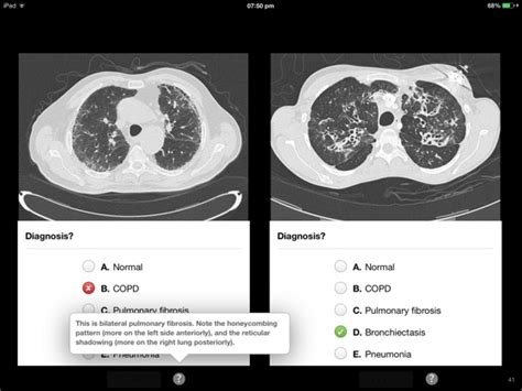 ‎radiology basics cross sectional imaging on apple books