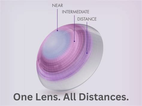 Top 5 Best Contact Lenses For Dry Eyes Of 2024