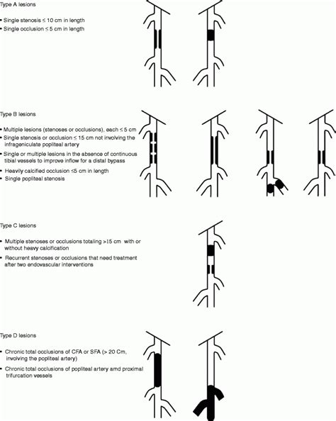 Overview Of Peripheral Arterial Disease Of The Lower Extremity