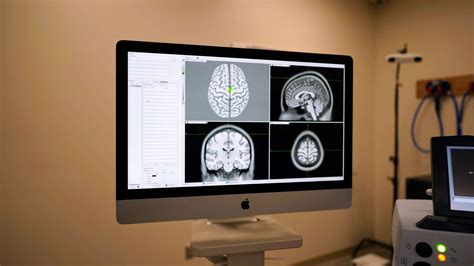 Non Invasive Neuromodulation Laboratory Research Core Mndrive Brain Conditions