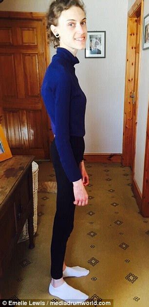 Anorexic Says Instagram Recovery Accounts Saved Her Daily Mail Online