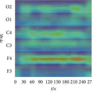 Class Activation Map Of PD Patients EEG Spectrogram With RBD