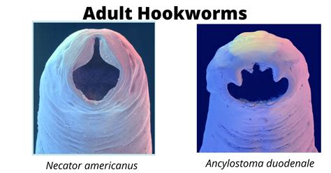 Hookworm Characteristics Life Cycle Pathogenesis And Diagnosis • Microbe Online