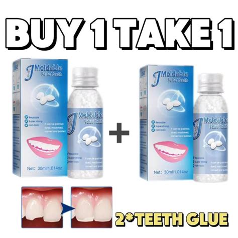 Lst 【buy 1 Take 1】30ml Temporary Tooth Repair Kit Filling Teeth Gaps
