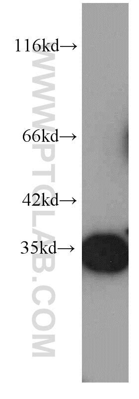 Rps3 Antibody 66046 1 Ig Proteintech