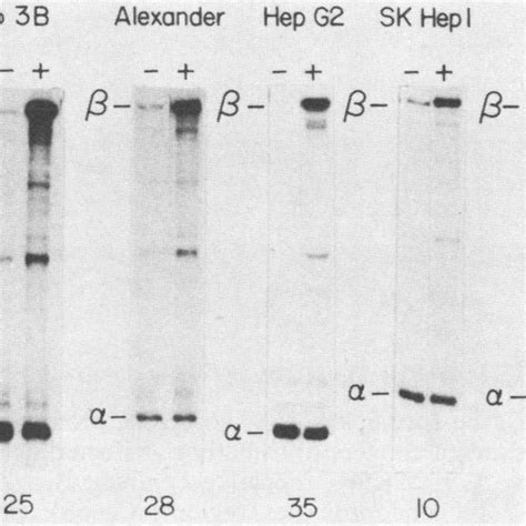 Hbv Enhancer Activity In Transfected Cell Lines En223 Was Constructed