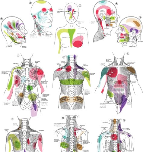 Anatomy Lab Trigger Points I Poster Laminated Anatomy And Physiology