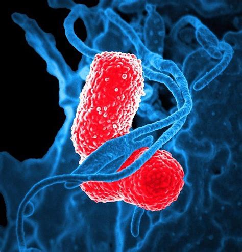 Klebsiella Antibiotic Coverage