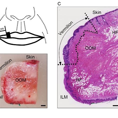 Development Of Rete Ridges Correlates With Age And Vascular Condition