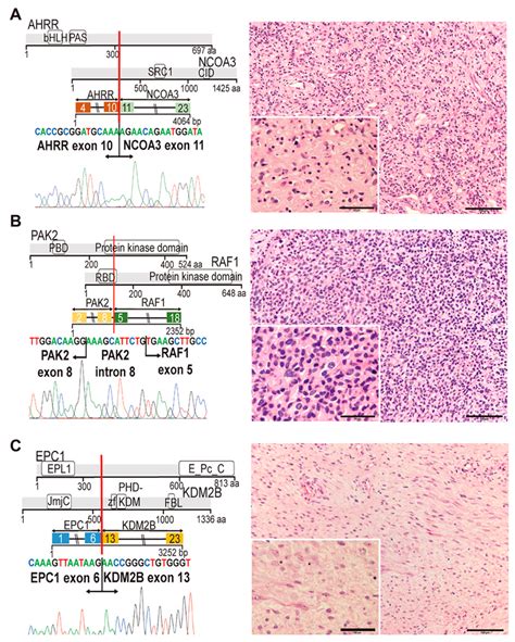 Diagrammatic Representation Of Three Novel Fusion Genes Part 1 Ac
