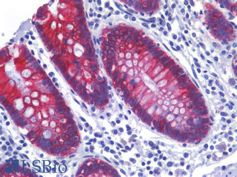 PathPlus CDH17 Cadherin 17 Monoclonal Antibody Mouse LSBio