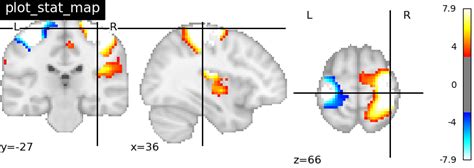 Nilearn Statistical Analysis For Neuroimaging In Python — Machine Learning For Neuroimaging