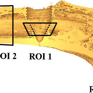 Midline Sagittal Slice Through A Volume Rendering Of The Segmented Bone
