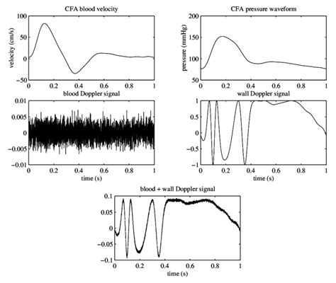 The Input Waveforms And The Output Signals From Left To Right And Top Download Scientific