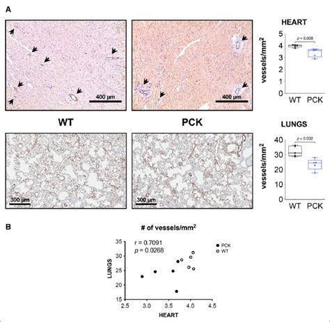 Immunohistochemical Analysis Of Vascular Density In Noncystic Organs
