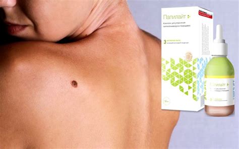 ПАПИЛАЙТ от папиллом🔴 КУПИТЬ капли или заказать в аптеке Средства в России в 2024 году