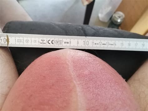 Saline Infusion Scrotum And Titti 3 L 72 Pics Xhamster