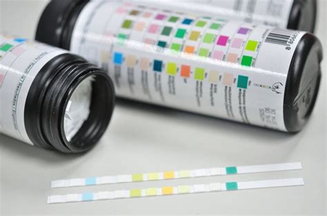 Diabetes And Urine Glucose Monitoring Au