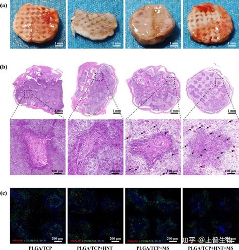 清华大学利用sunpbp11低温沉积3d打印构建促血管化骨再生的多机制药物控释支架体系 知乎